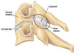 Wry Neck (Acute Torticollis) - Essential Physio Essential Physio